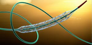 Neurovascular Devices Market Expected to Expand at a Steady 2024-2031 ...