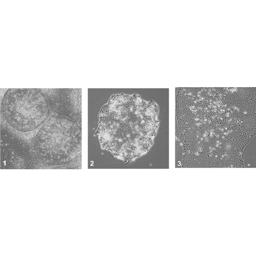 New iPSC Lines Created for Clinical Development